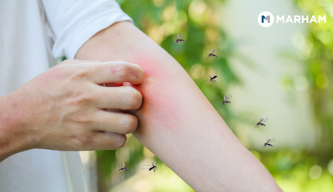 Dengue Fever in 2025: A Growing Health Threat in Pakistan - Marham