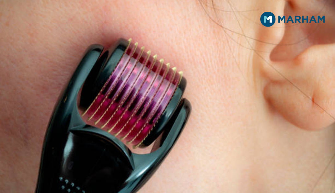 Derma Roller Price in Pakistan, Benefits, and How It Is Used