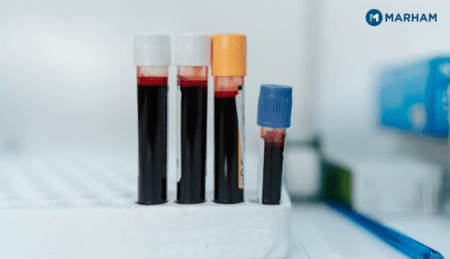 MCH Blood Test: Essential Guide to Normal Range, Low & High Levels
